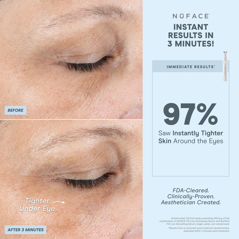 15-Minute Facial Lift – NuFACE