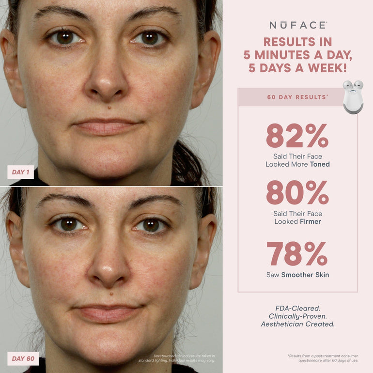 15-Minute Facial Lift – NuFACE