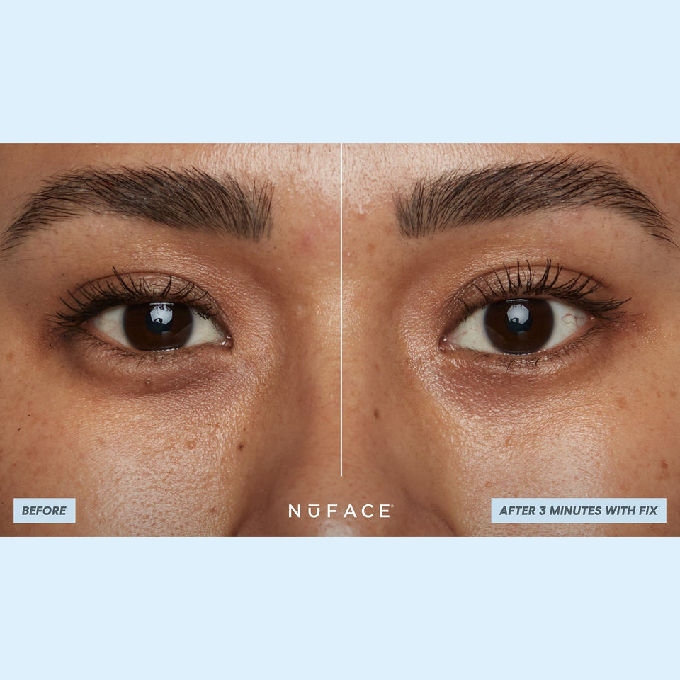 IonPlex® Hydra-Gel Power Patches - Eye Masks | NuFACE